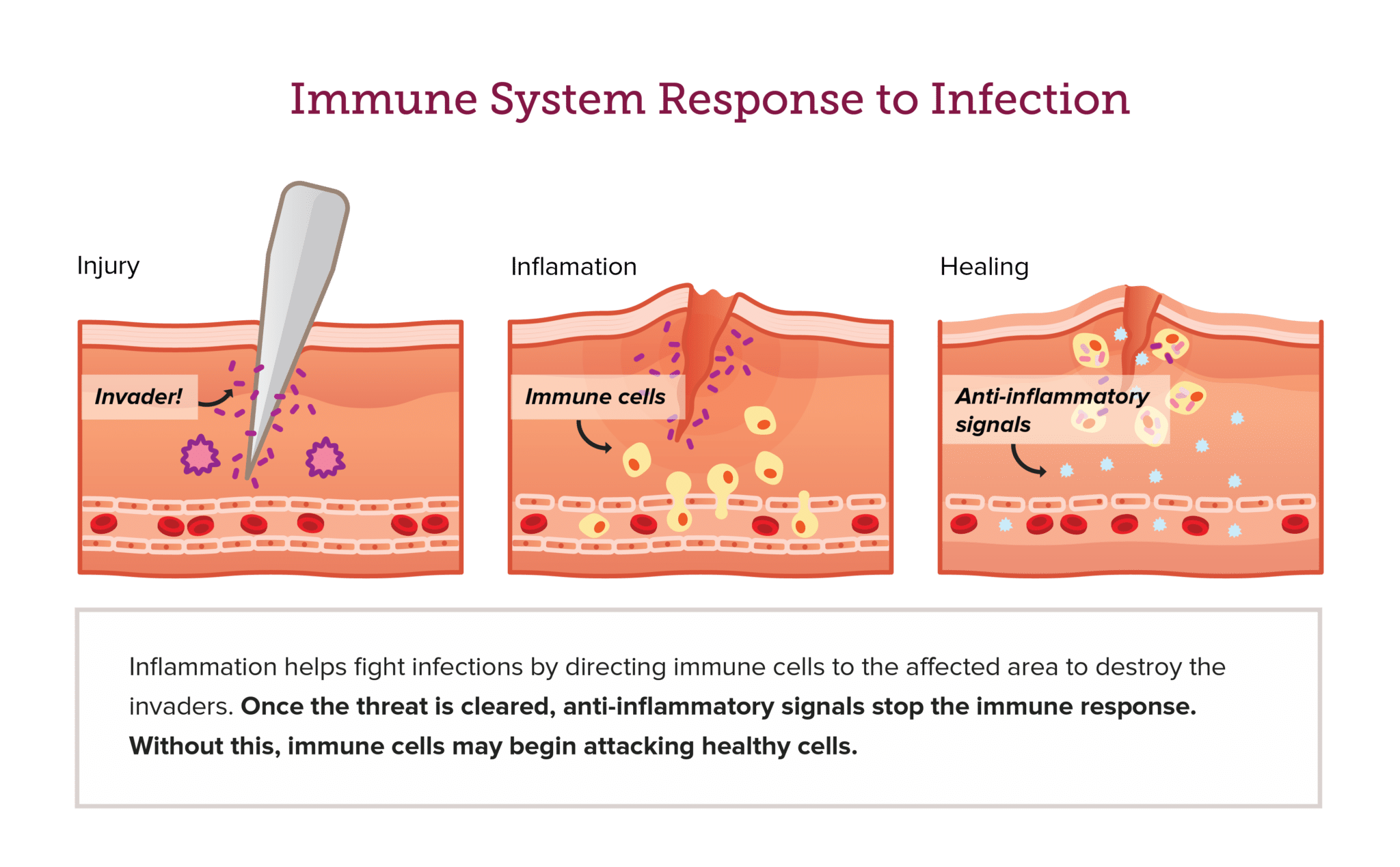 Why Are Autoimmune Diseases More Common in Women? The Estrogen ...